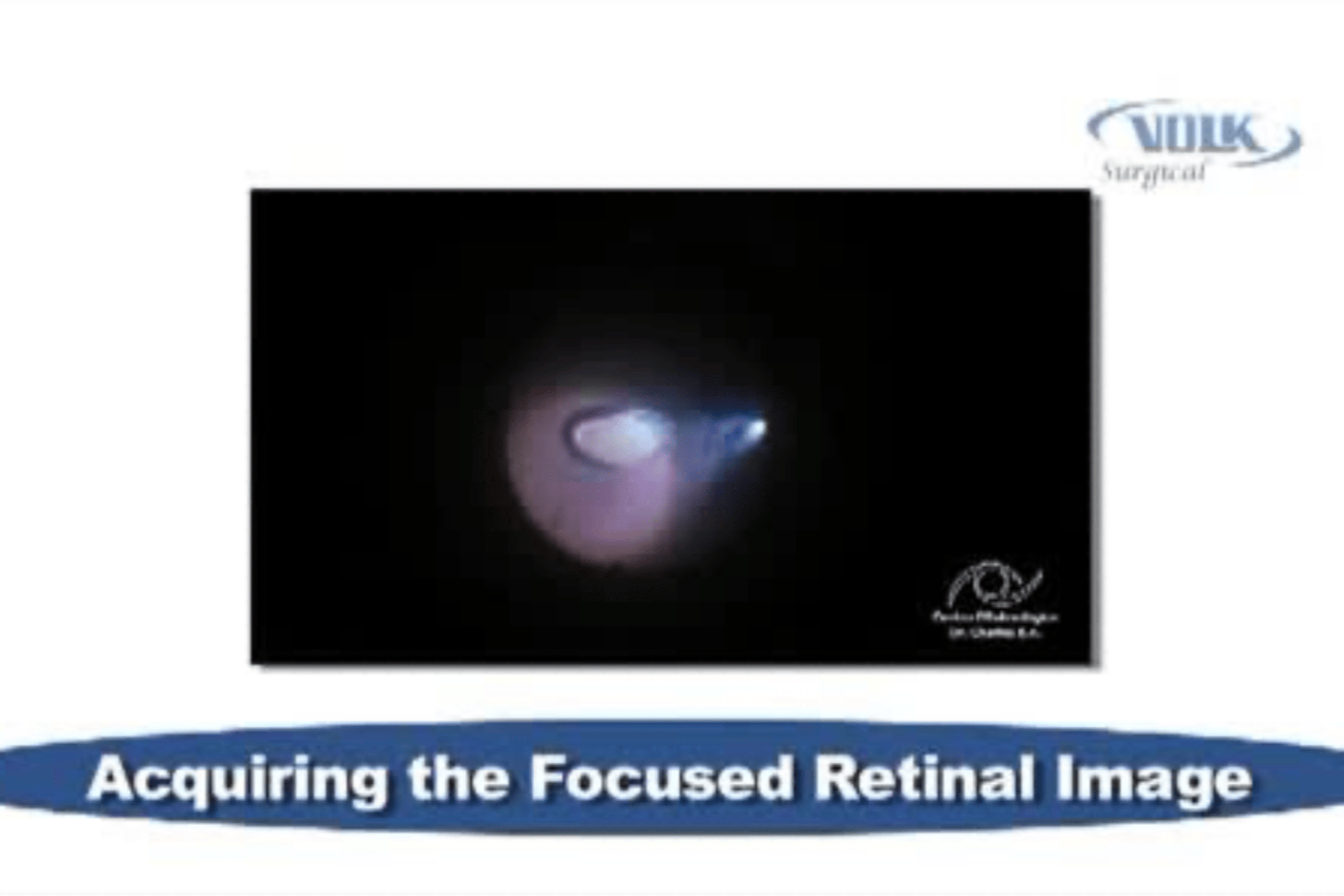 Product Guides | Surgical Viewing Systems - Volk Optical